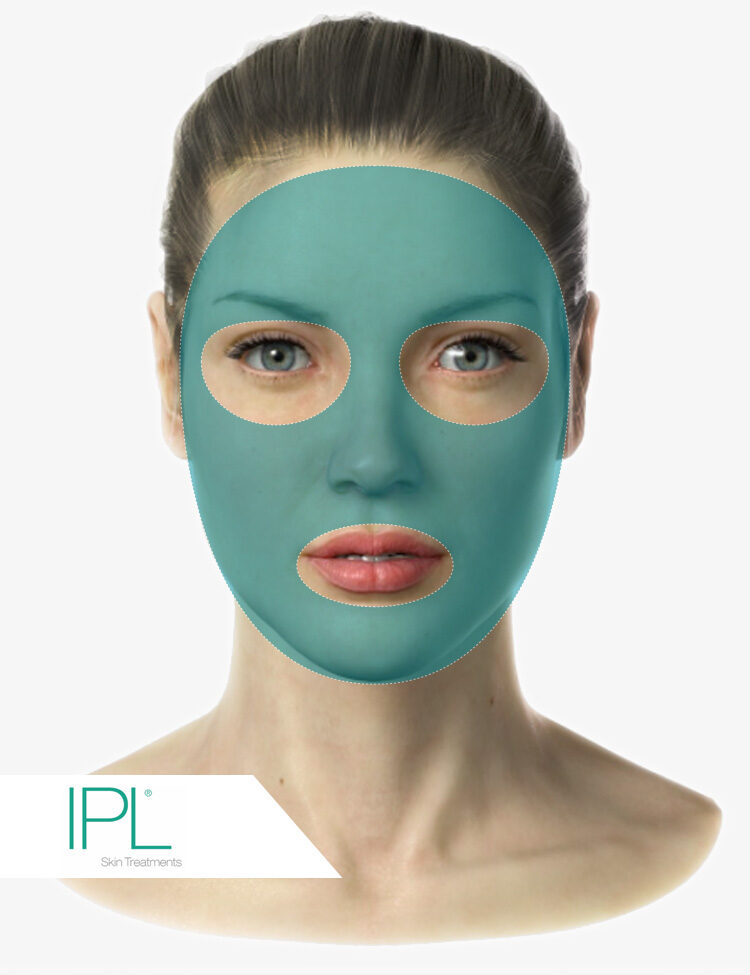 IPL Photofacial - DMH Aesthetics